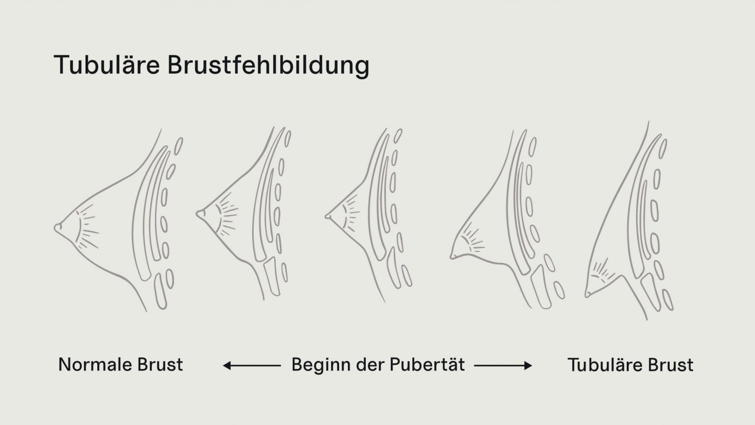 Behandlungen der Brust bei Aesthemedica